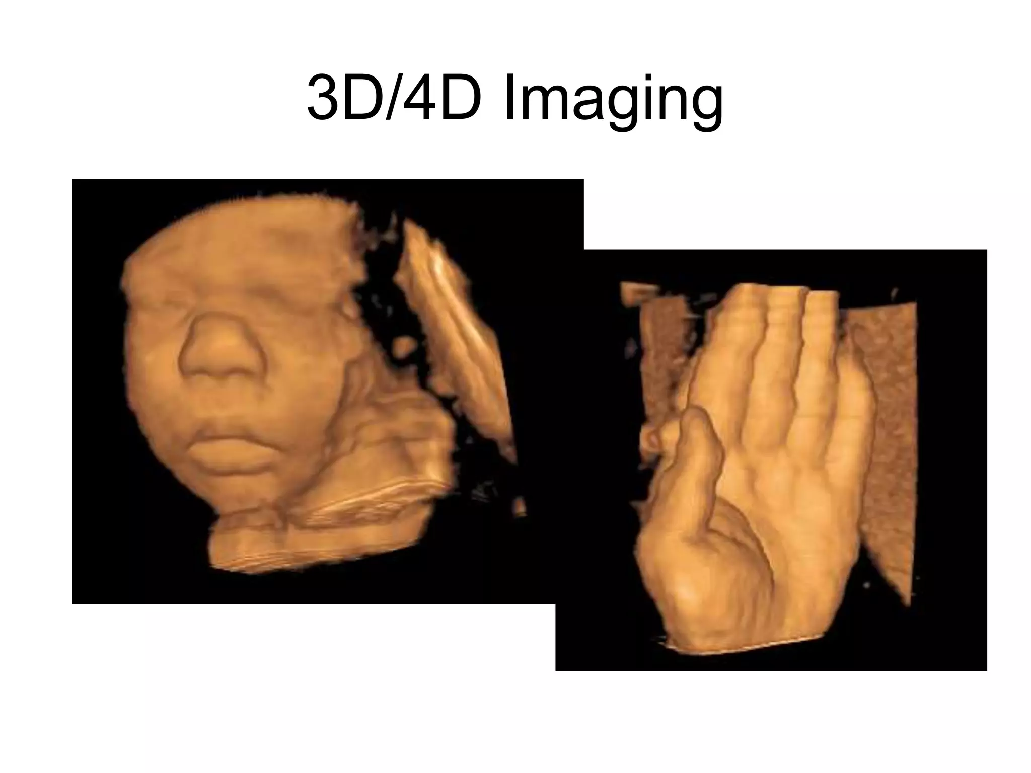Ultrasound Basics.pptx