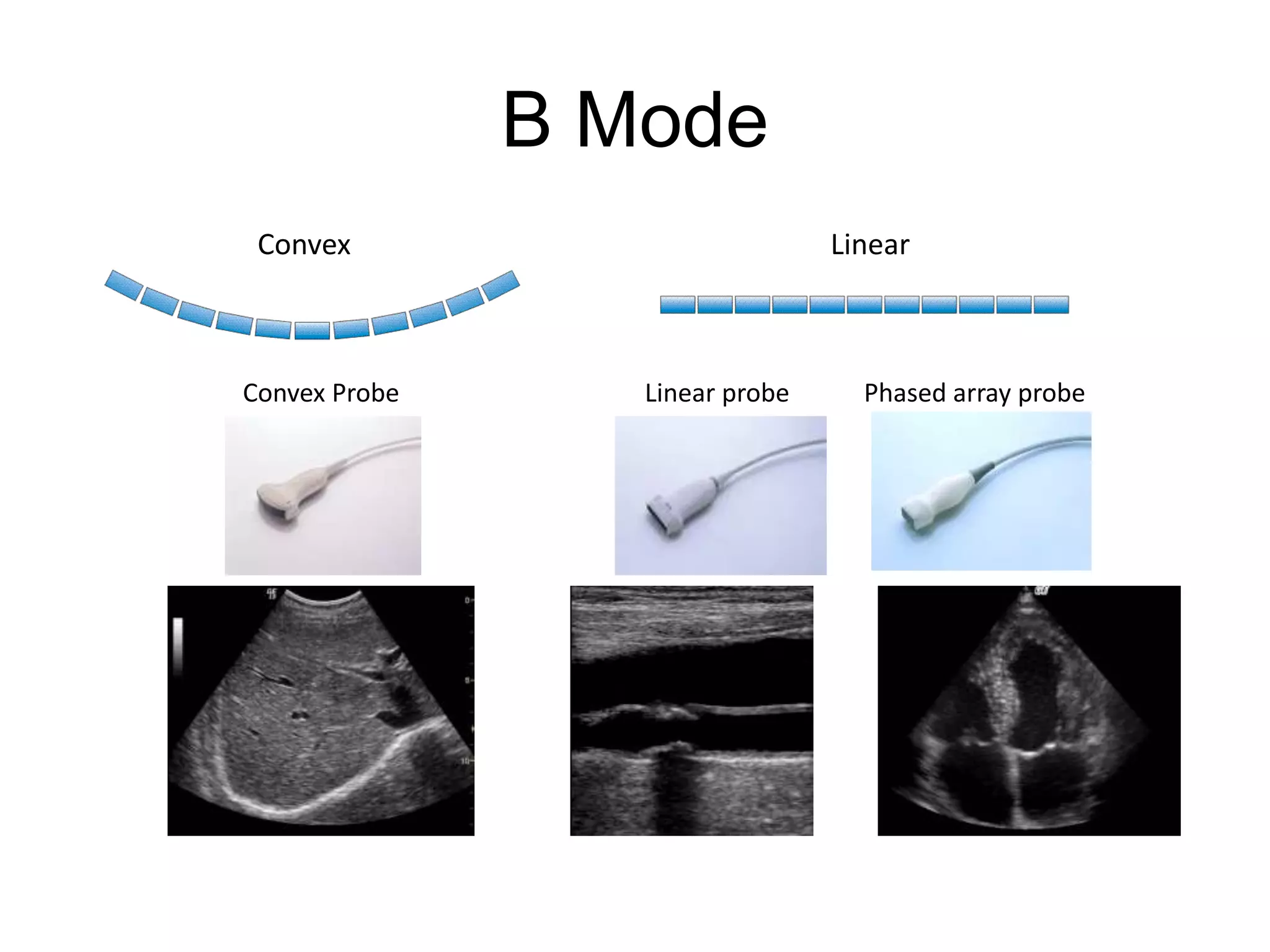 Ultrasound Basics.pptx