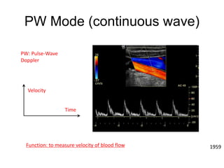 Ultrasound Basics.pptx