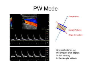 Ultrasound Basics.pptx