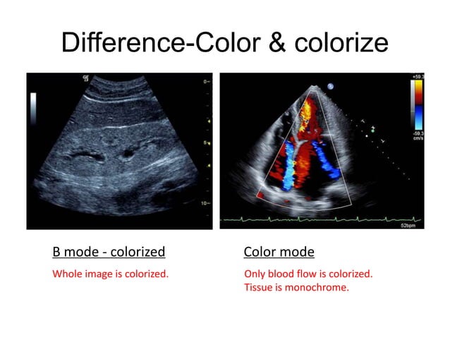 Ultrasound Basics.pptx