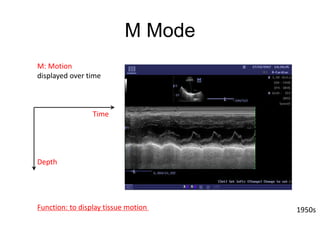 Ultrasound Basics.pptx