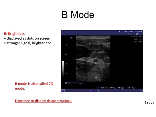 Ultrasound Basics.pptx