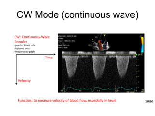 Ultrasound Basics.pptx