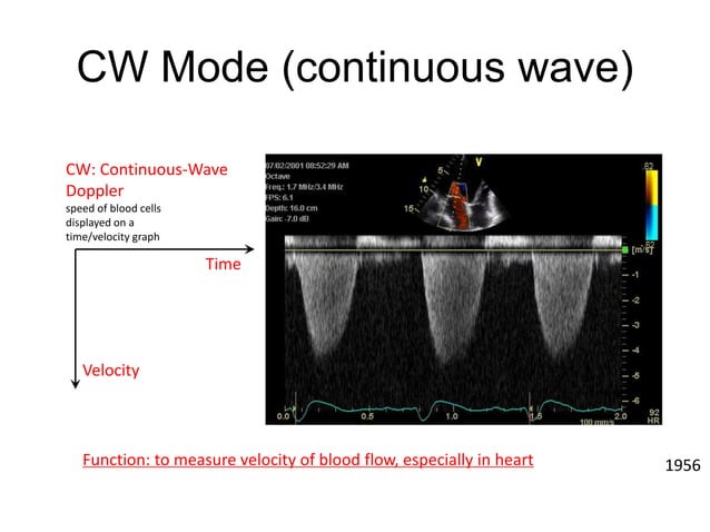 Ultrasound Basics.pptx