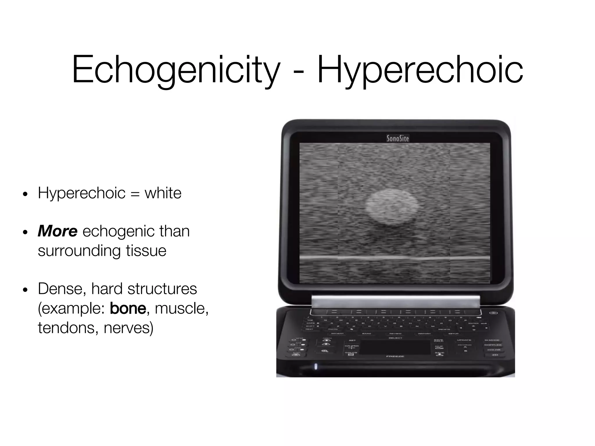 Ultrasound Basics-Knobology Hamisi Mkindi2.pptx