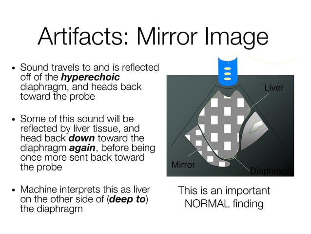 Ultrasound Basics-Knobology Hamisi Mkindi2.pptx | Digital Audio ...