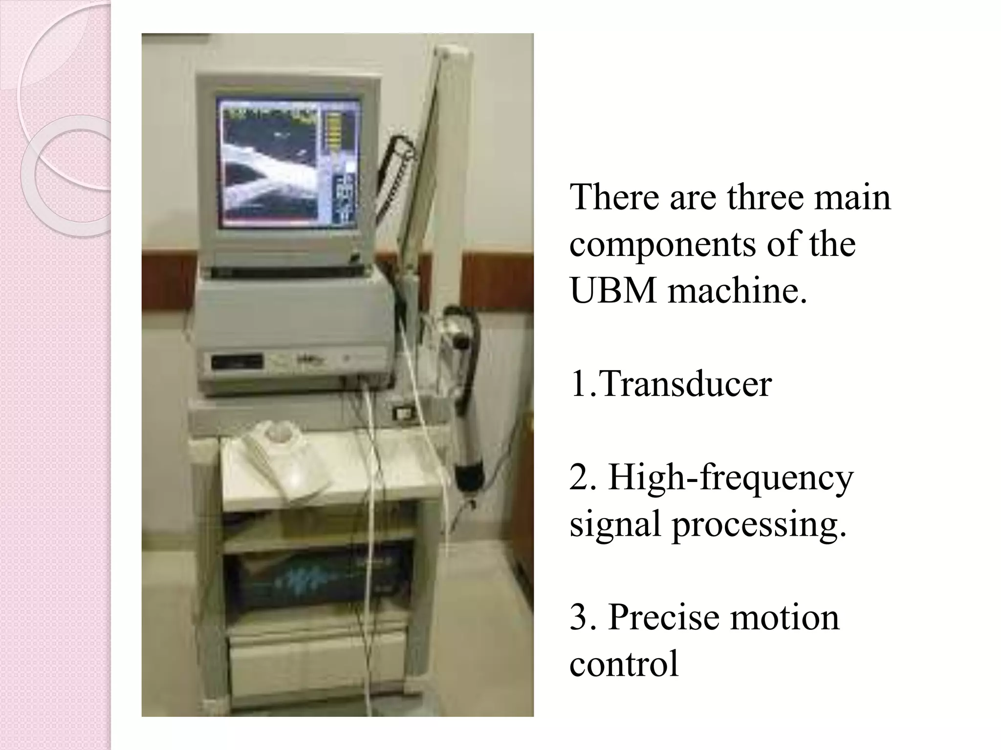 Ultrasound biomicrosopy in glaucoma | PPTX