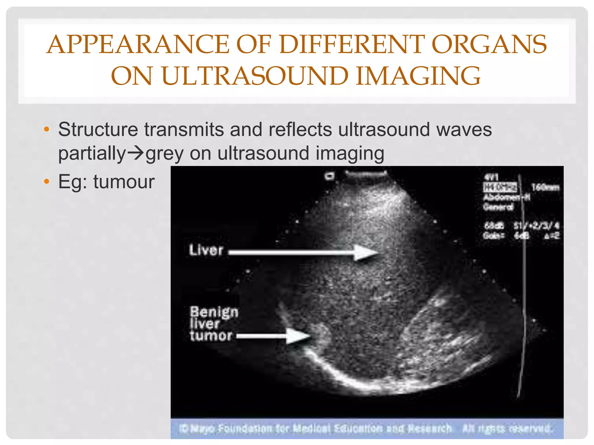 Ultrasound | PPTX