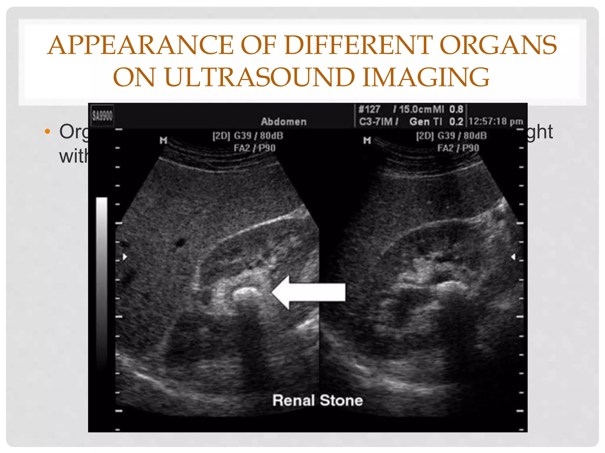 Ultrasound | PPTX