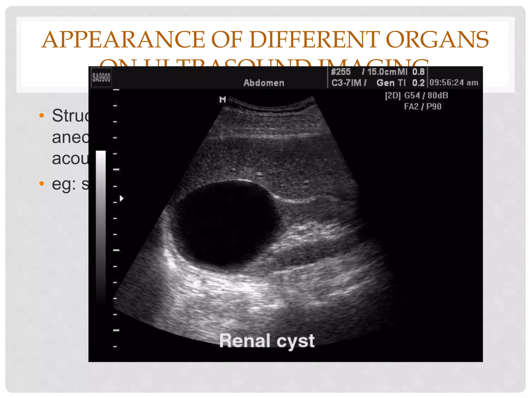Ultrasound | PPTX