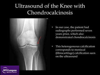 Ultrasound case of the month nov 13 | PPTX