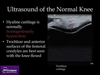 Ultrasound case of the month nov 13 | PPTX