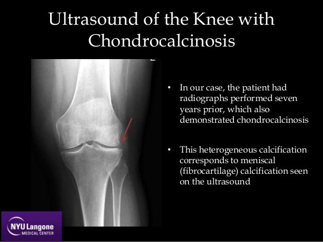 Ultrasound case of the month nov 13