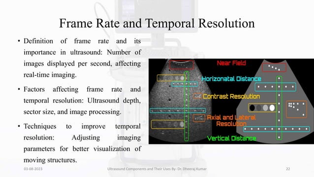 ULTRASOUND COMPONENTS AND THEIR USES.pptx