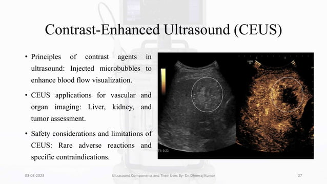 ULTRASOUND COMPONENTS AND THEIR USES.pptx