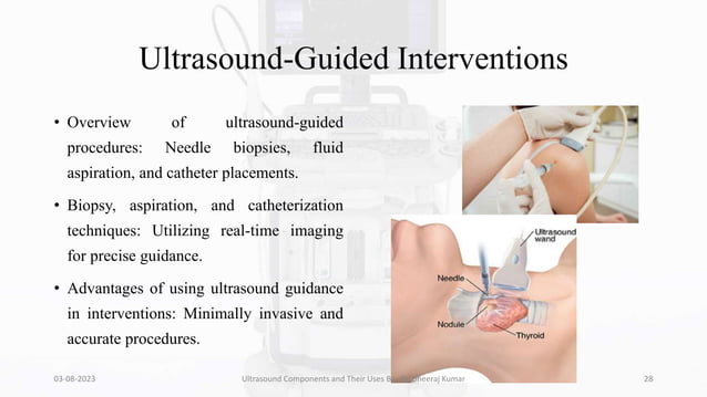 ULTRASOUND COMPONENTS AND THEIR USES.pptx
