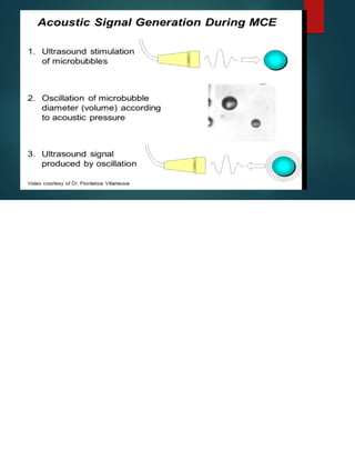 Ultrasound Contrast agent .ppt