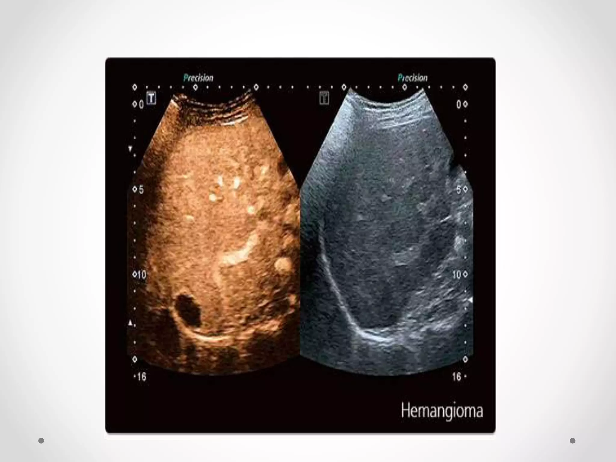 Ultrasound contrast agents | PPTX