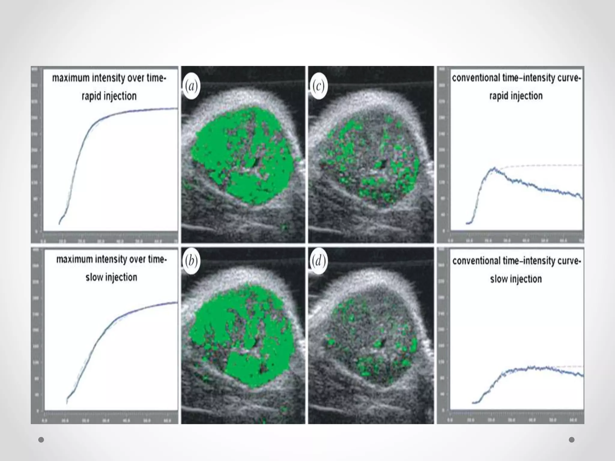 Ultrasound contrast agents | PPTX