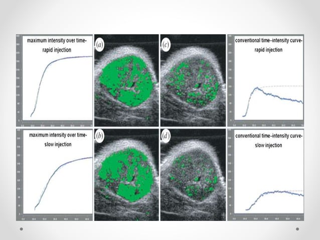 Ultrasound contrast agents | PPTX