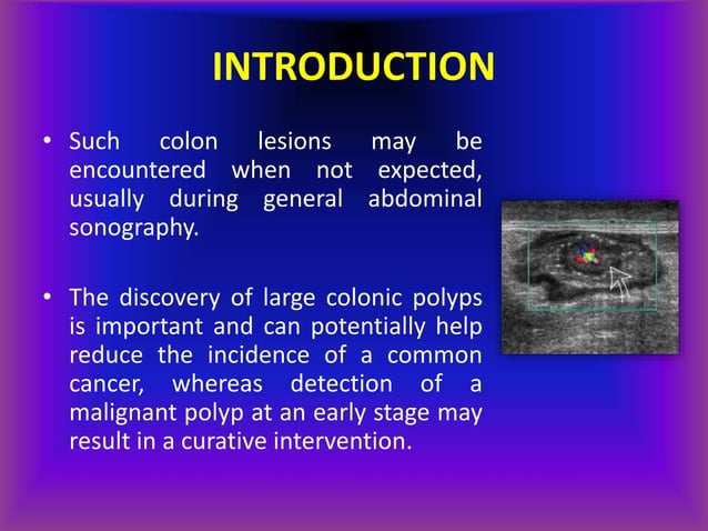 Ultrasound detection of colonic polyps Dr. Muhammad Bin Zulfiqar | PPTX | Medical Health