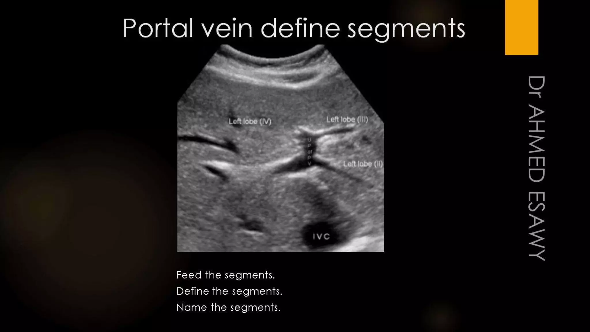 Ultrasound diffuse liver disease all things fibrosis,cirrhosis,us ...