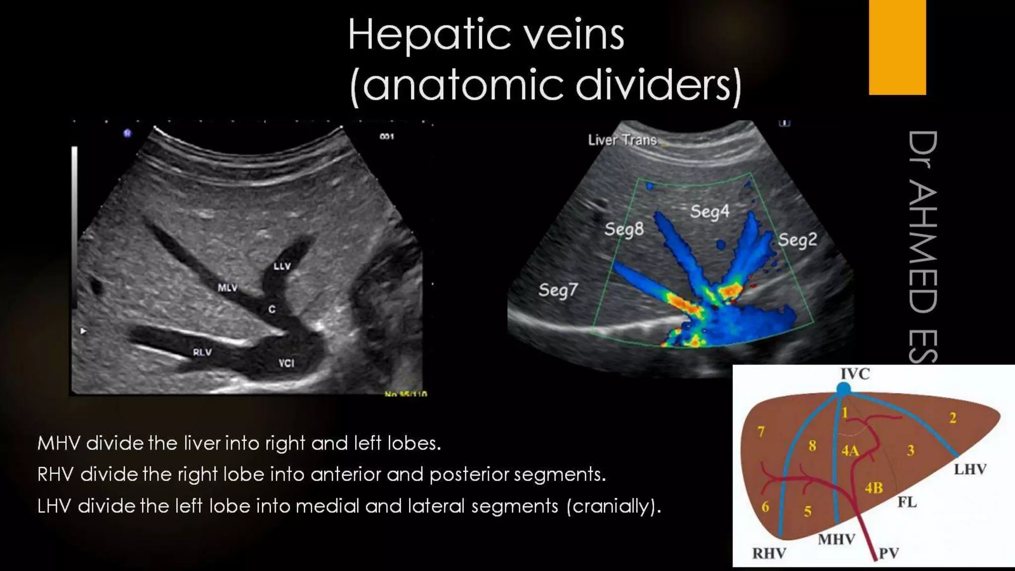 Ultrasound diffuse liver disease all things fibrosis,cirrhosis,us ...
