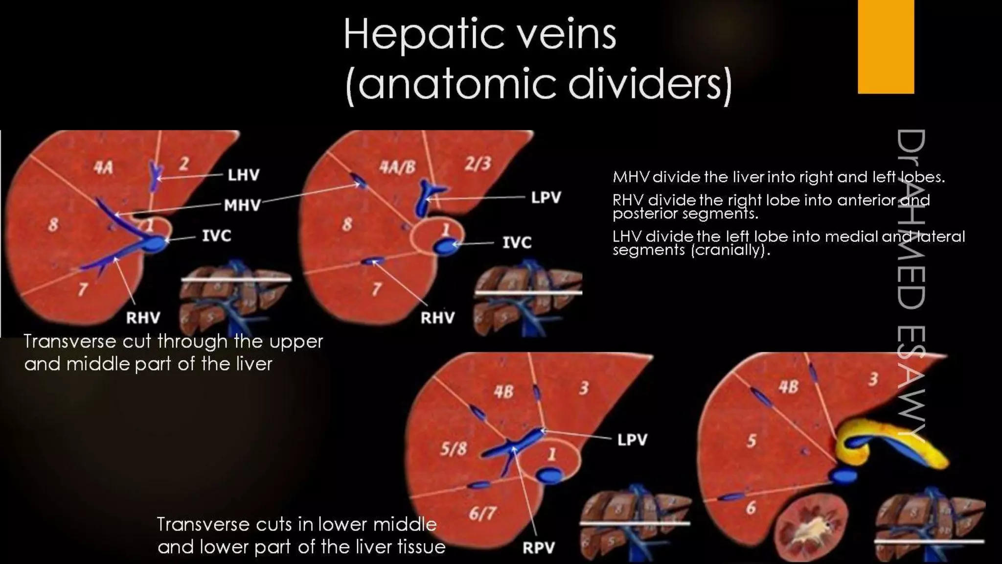 Ultrasound diffuse liver disease all things fibrosis,cirrhosis,us ...