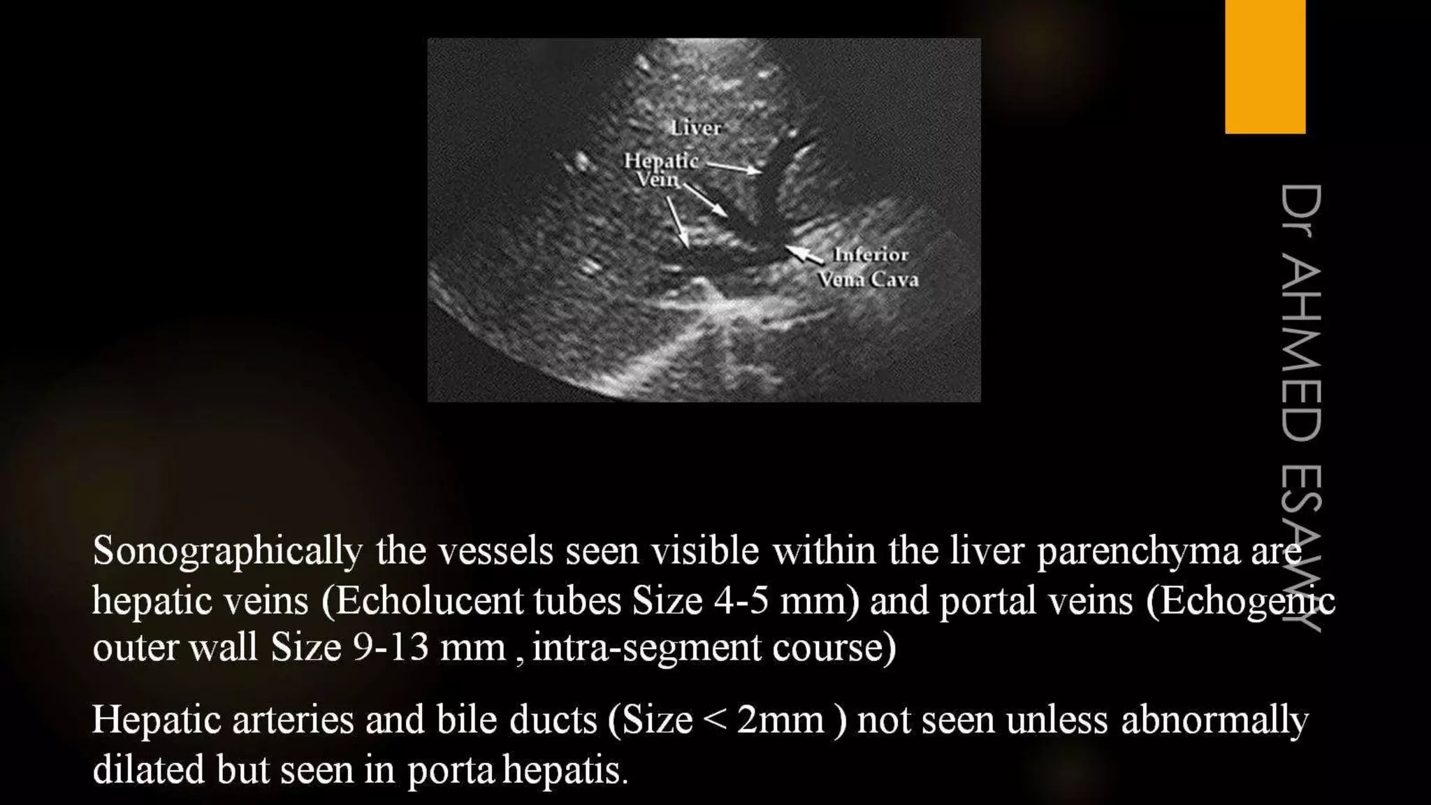 Ultrasound diffuse liver disease all things fibrosis,cirrhosis,us ...