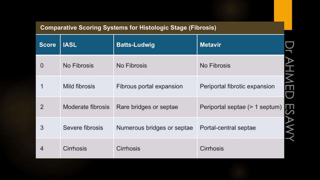 Ultrasound diffuse liver disease all things fibrosis,cirrhosis,us ...
