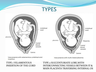 ULTRASOUND & DOPPLER DURING PREGNANCY.pptx
