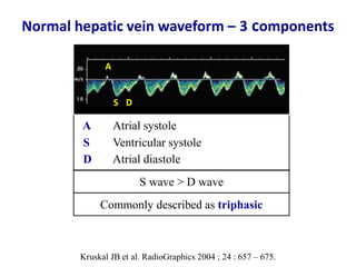 Ultrasound & doppler ultrasound in liver transplantation | PPTX
