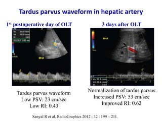 Ultrasound & doppler ultrasound in liver transplantation | PPTX