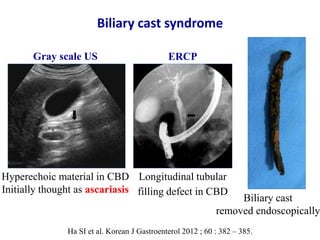 Ultrasound & doppler ultrasound in liver transplantation | PPTX