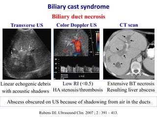 Ultrasound & doppler ultrasound in liver transplantation | PPTX