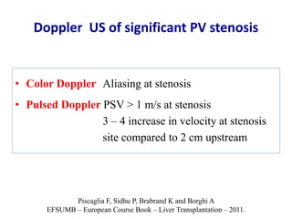 Ultrasound & doppler ultrasound in liver transplantation | PPTX