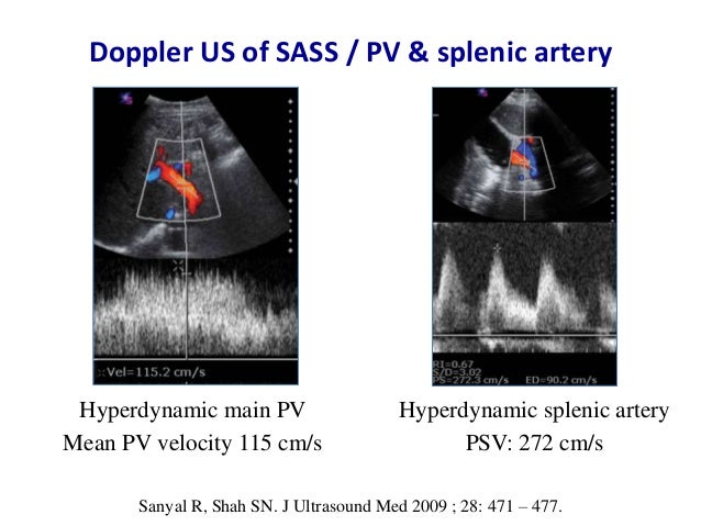 Splenic Artery Ultrasound