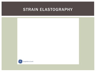 Ultrasound Elastography: Principles, techniques & clinical applications ...