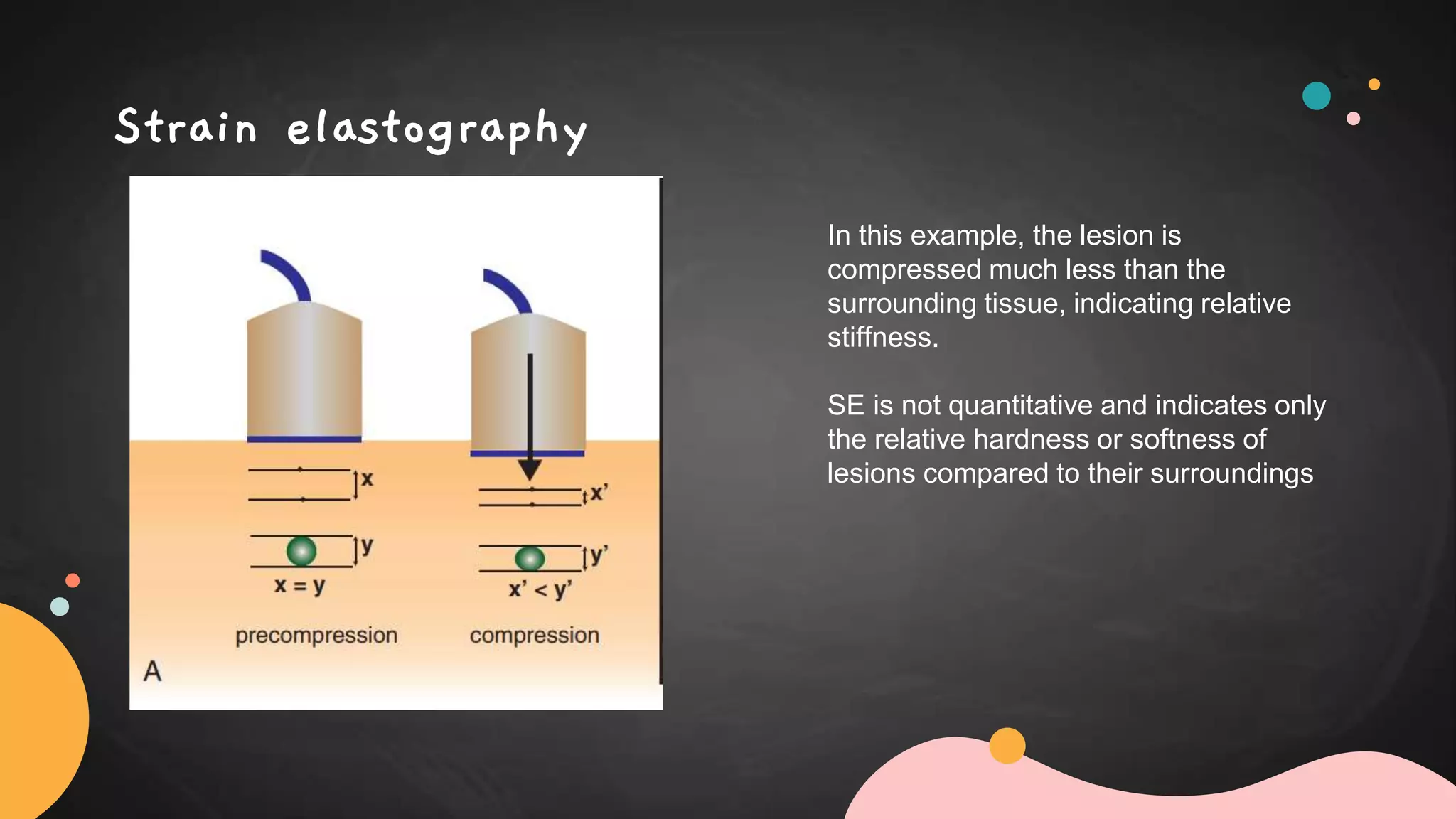 Ultrasound elastography | PPTX