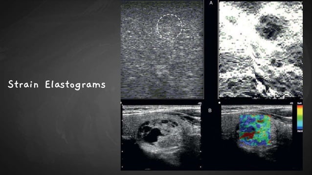 Ultrasound elastography | PPTX | Physics | Science