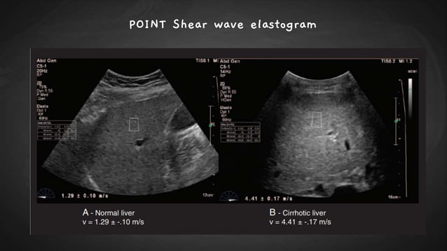 Ultrasound elastography | PPTX | Physics | Science