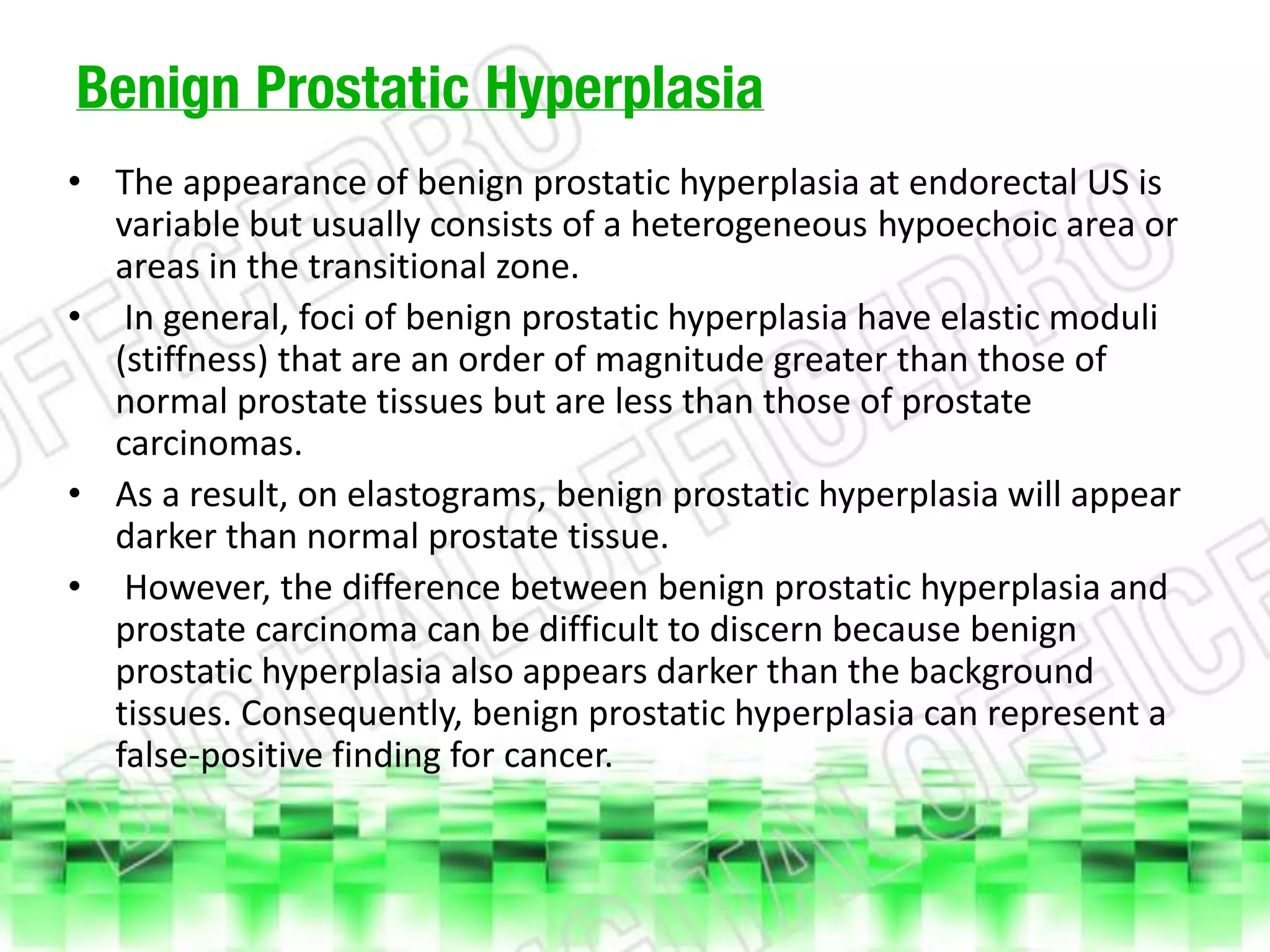 Ultrasound elastography of breast and prostate lesions | PPTX