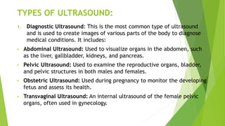 ULTRASOUND EQUIPMENT | PPTX