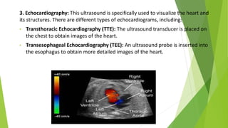 ULTRASOUND EQUIPMENT | PPTX