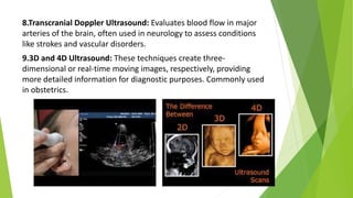 ULTRASOUND EQUIPMENT | PPTX
