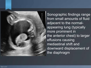 Ultrasound evaluation of fetal thorax | PPT