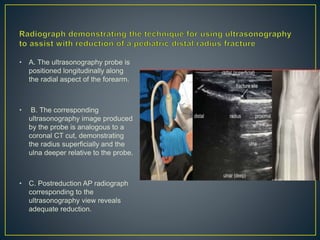 Ultrasound evaluation of pediatric orthopaedic patient | PPT