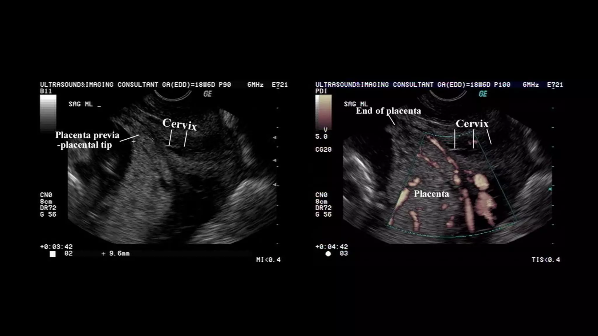 Ultrasound examination of the third trimester of pregnancy | PPTX