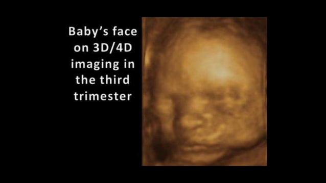 Ultrasound examination of the third trimester of pregnancy | PPTX ...